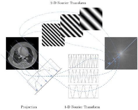 Biomedical Engineering How Is The First Image Estimate Generated In CT Scan Iterative