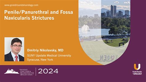 Penilepanurethral And Fossa Navicularis Strictures