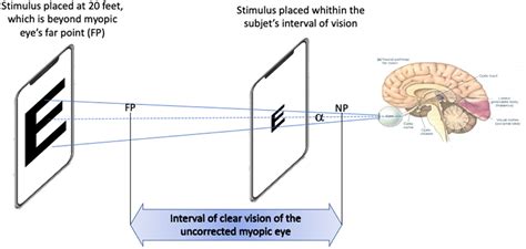 Clinical Validation Of A Novel Smartphone Application For Measuring