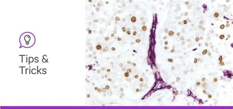Top Considerations For Selecting Immunohistochemistry Ihc Detection Reagents Vector Labs