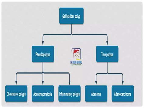 Gallbladder Polyp Pptx