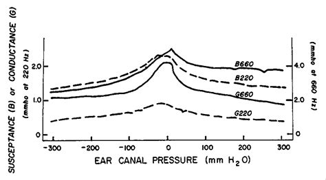 Tympanogram Types And Meanings At William Everhart Blog