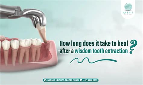 How Long Does It Take To Heal After A Wisdom Tooth Extraction Mint