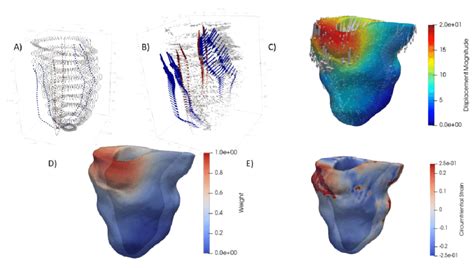 overview of displacement interpolation and strain calculation pipeline