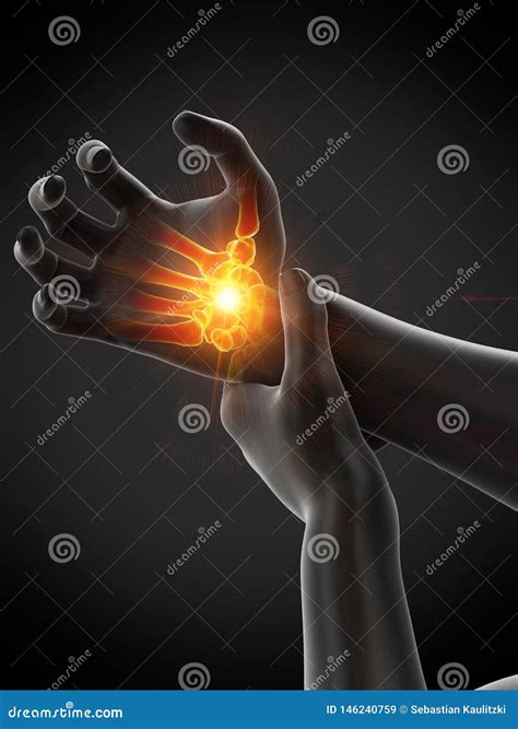 Una mu eca dolorosa stock de ilustración Ilustración de humano 146240759