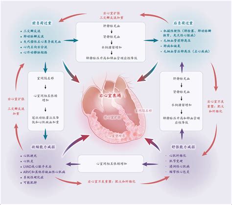 Nejm：右心室衰竭 贪吃的夜猫子