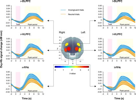 Cortical Activation Patterns During Performance Of The Color Word