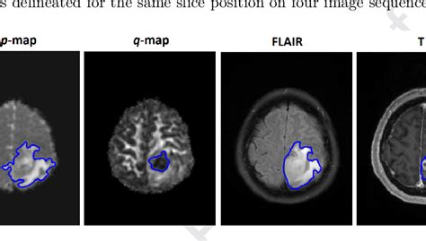 four different mri modalities and their relevant ground truth
