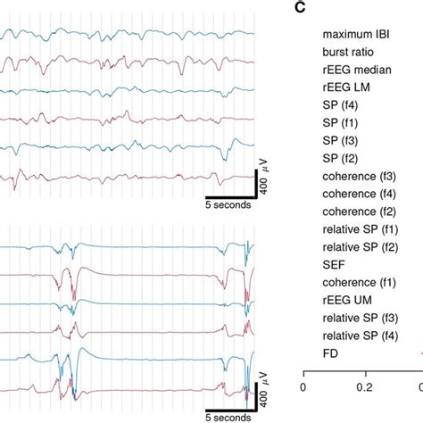 Procedure For Generating QEEG From Continuous EEG Download Scientific Diagram