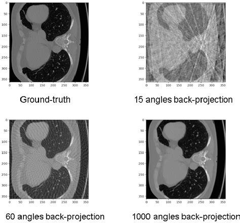 Figure 1 From A Novel Design Of Industrial Real Time Ct System Based On Sparse View