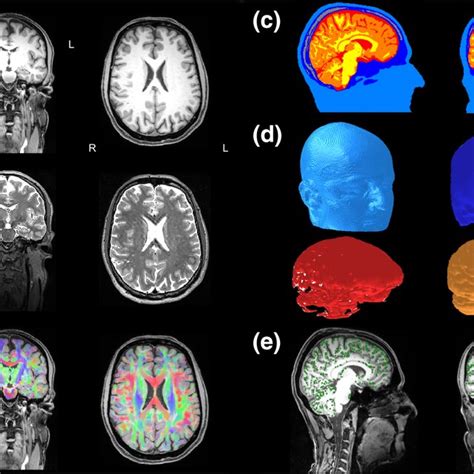 Calibrated Head Models A Six Compartment Anisotropic Calibrated Download Scientific Diagram