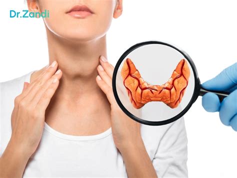 غده تیروئید چیست؟ علائم، عوارض و راه درمان آن دکتر عبدالله زندی