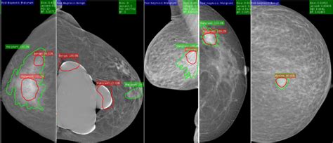 examples of various detection segmentation and classification