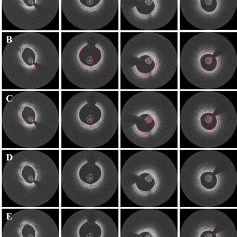 Segmentation Results With And Without Data Augmentation And