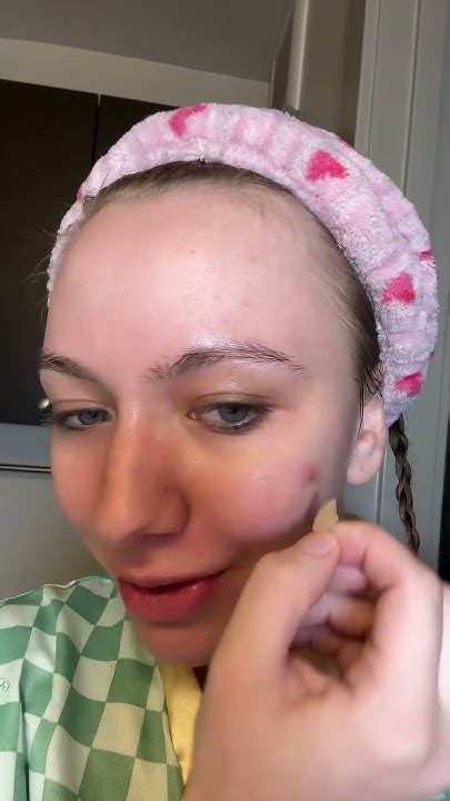 This Only Works With Slay Dot Pimple Patches Slaydot Youtube