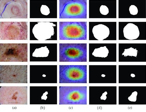 segmentation results generated by the cl dcnn model at each stage a