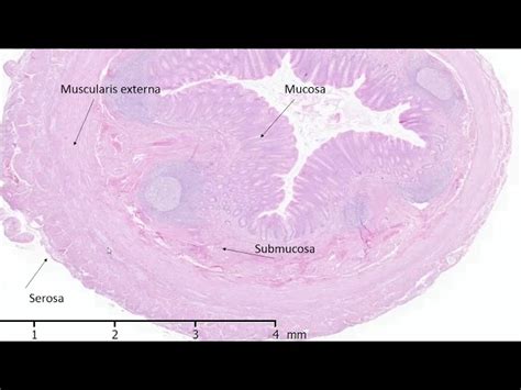 Appendix Histology Layers Appendix Blog