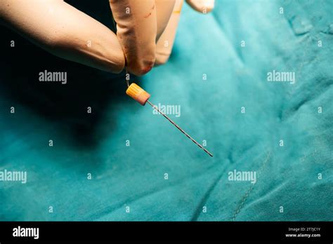 Closeup View Neurosurgeon Hand Holding Stereoelectroencephalography Electrode Or Stereoeeg For