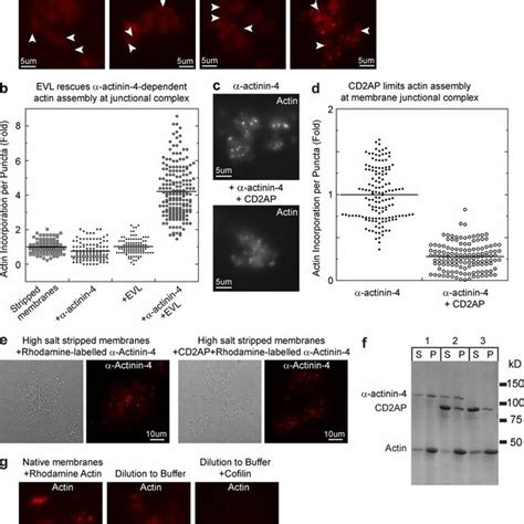 Cd2ap Inhibits Actin Polymerization And Depolymerization By Capping Download Scientific Diagram