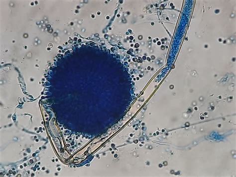 Lactophenol Cotton Blue Lpcb Archives Medical Notes
