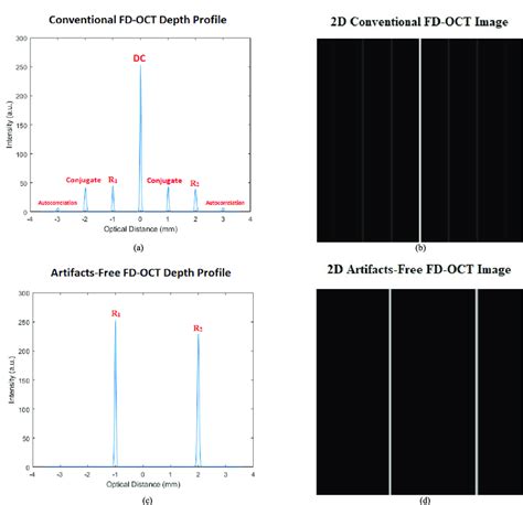 Sample Of The Fd Oct Dataset A Conventional Fd Oct Depth Profile B