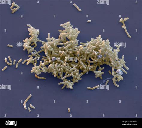 Bifidobacterium Bacteria Coloured Scanning Electron Micrograph Sem Of A Cluster Of