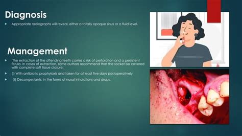 Space Infection Of Maxillary Sinus Chronic And Acute Pptx