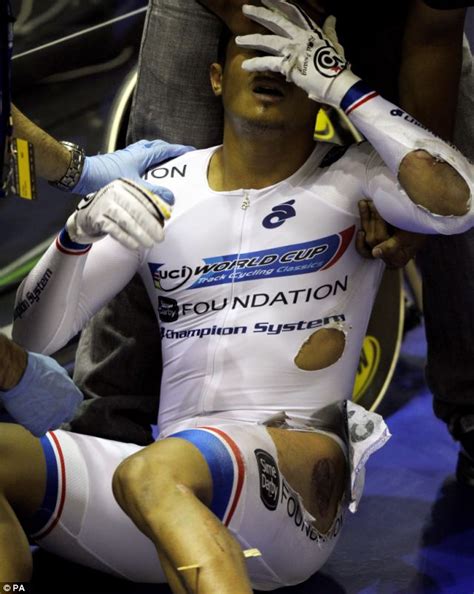 Cyclist Azizulhasni Awang Leg Skewered By Shard Of Wood But He Finishes Race Daily Mail Online