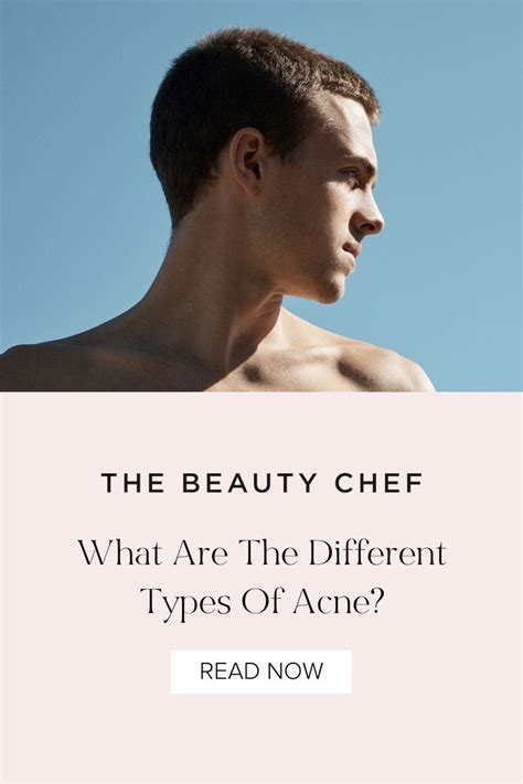 Different Types Of Acne A Comprehensive Guide