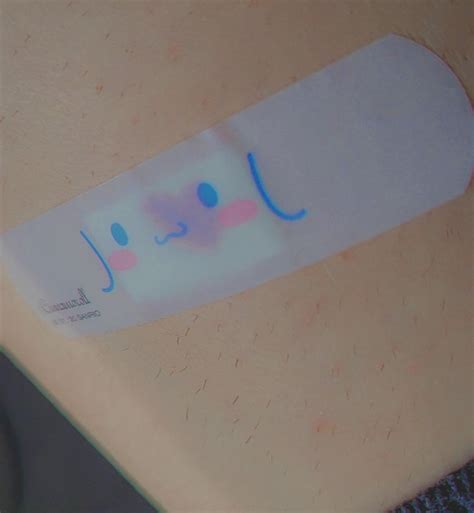 I Hit A Capillary While Doing My Injection But Look The Blood Made A Heart Shape ♡ Rtrans I Hit A Capillary While Doing My Injection But Look The Blood Made A Heart Shape ♡ Rtrans