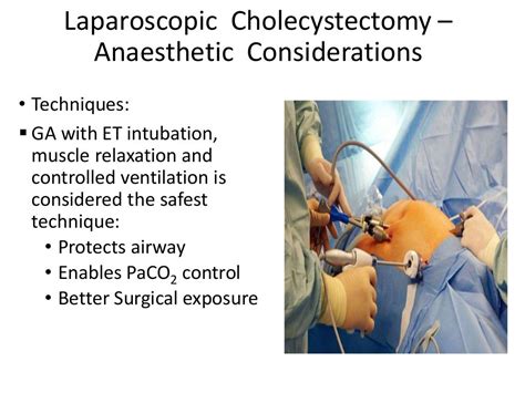 Anaesthesia For Lap Chole Ppt