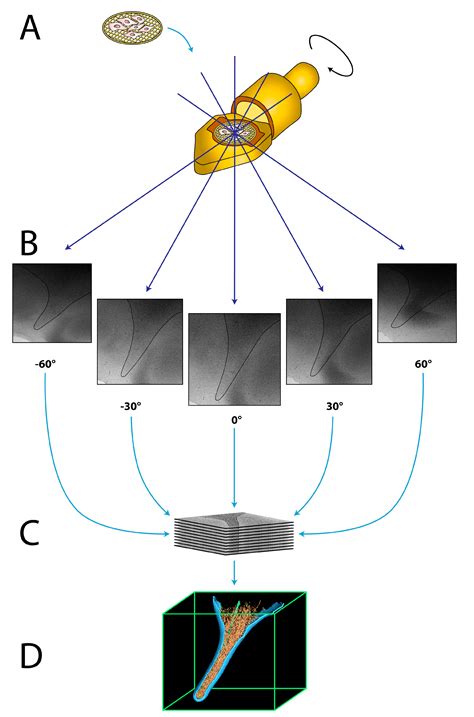 Cellular And Structural Studies Of Eukaryotic Cells By Cryo Electron