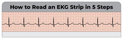 How To Read An EKG Strip In Steps CardiacDirect