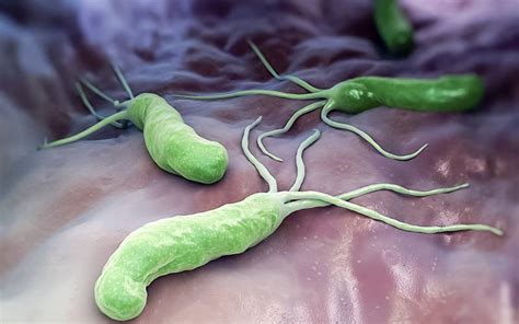 Helicobacter Pylori Infection And Autoimmune Thyroid Diseases Is There An