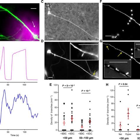 Increases Of Axonal Membrane Tension Lead To Retraction Of Growth Cone