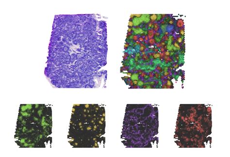 Github Rockdemechrysalis Powerful And Lightweight Package To Identify Tissue Compartments In