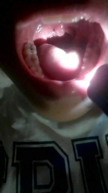 Asian Uvula 08 Asian Uvula 08