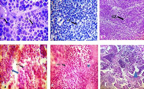 Light Micrograph Of The Testis Of Rainbow Trout From S1 Site Depicting