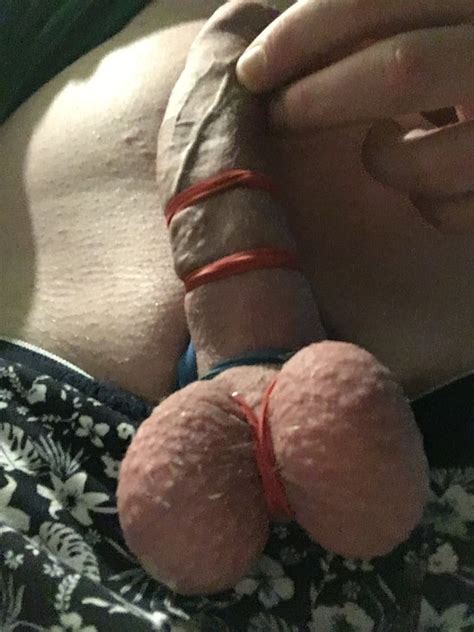 Cock And Ball Bondage With Rubber Bands 17 Pics Xhamster