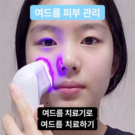 1초픽 여드름 난 사람들에게 추천하는 여드름 치료기 집에서 쉽게 여드름을 관리할 수 있어요