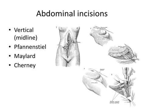 Ppt Pelvic Surgical Anatomy Powerpoint Presentation Free Download