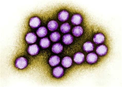 Free Picture Colorized Transmission Electron Micrograph Adenovirus