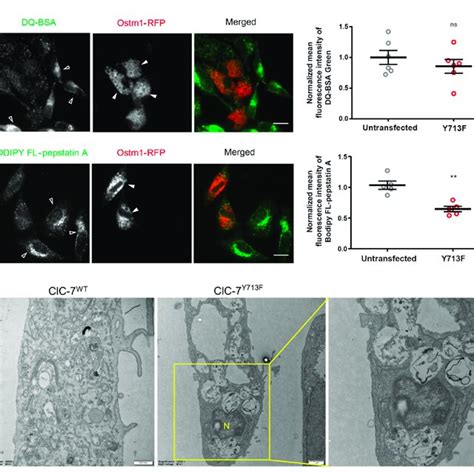 Enlarged Compartments Can Be Of Autolysosomal Nature A Download
