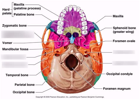 Temporal Bone Diagram Quizlet