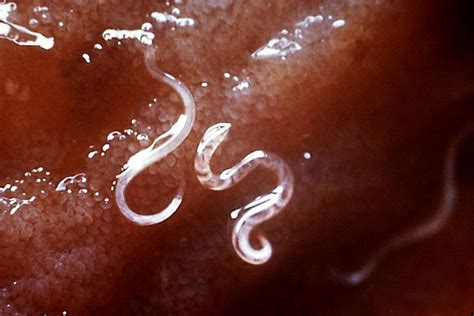 What Is The Difference Between Hookworm And Roundworm Pediaa Com