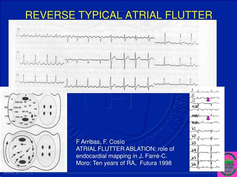 Ppt Minimaster Di Elettrocardiografia Powerpoint Presentation Free Download Id 3257177