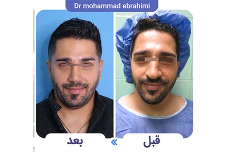 دکتر محمد ابراهیمی فوق تخصص جراحی پلاستیک و زیبایی