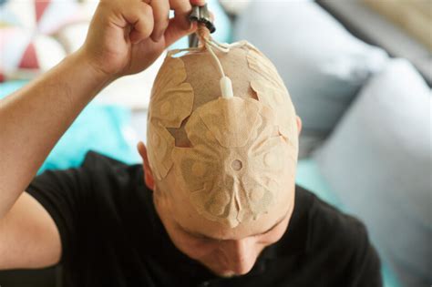 Glioblastom Und Astrozytom Grad 4 Therapien Optunede