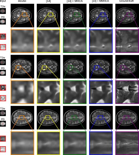 Multimodal Multi Head Convolutional Attention With Various Kernel Sizes For Medical Image Super