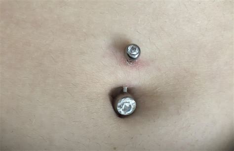 Is This Normal For Belly Button Piercing Ive Had It For A Month Now